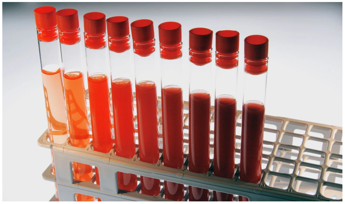 MultiNeb OID-ICP-MS - Ingeniatrics